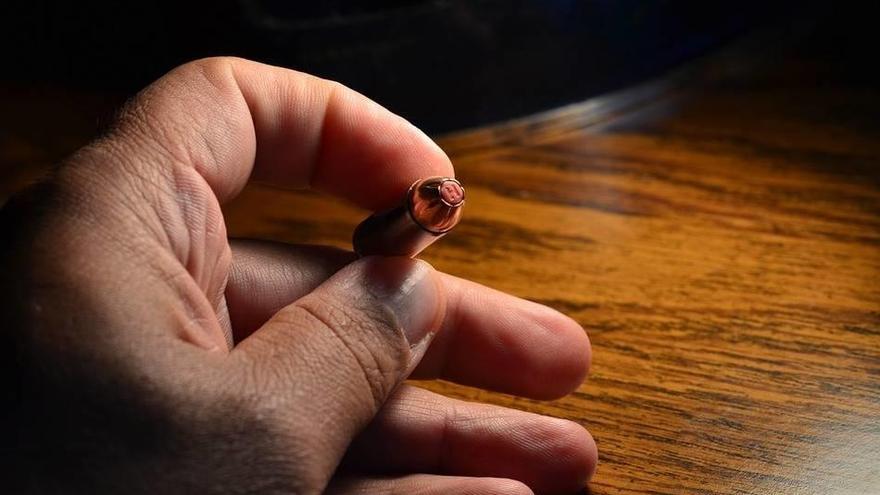 Acude al hospital con dolores de cabeza y hallan una bala en su cráneo